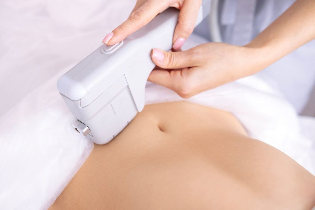 HIFU corporal | Dra Margarita Esteban